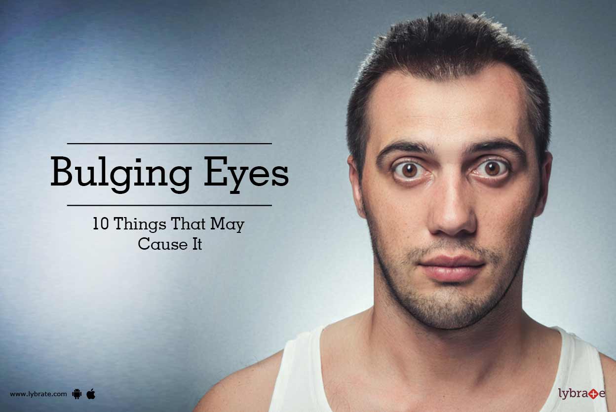 What Causes Bulging Eyes In Es Frameimage