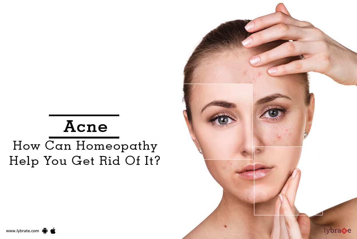 Acne - How Can Homeopathy Help You Get Rid Of It? - By Dr. Bindia Arora ...