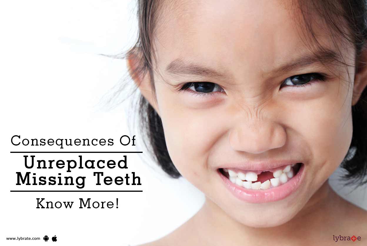 Consequences Of Unreplaced Missing Teeth - Know More! - By Dr. Manoj ...