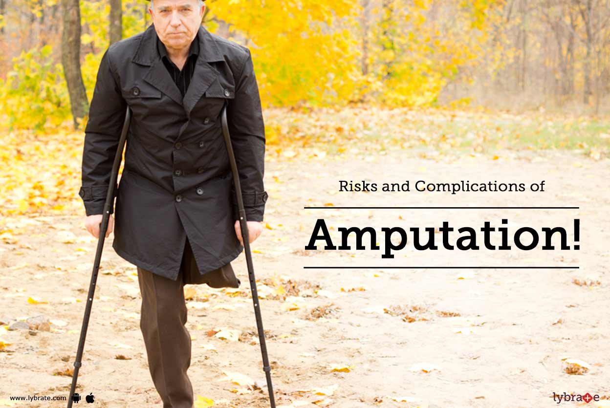 Risks and Complications of Amputation! - By Dr. Deepak Subramanian ...