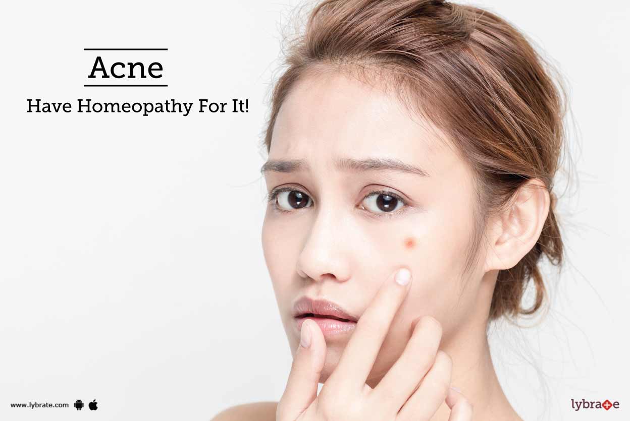 Acne - Have Homeopathy For It! - By Dr. Vijay Singh | Lybrate