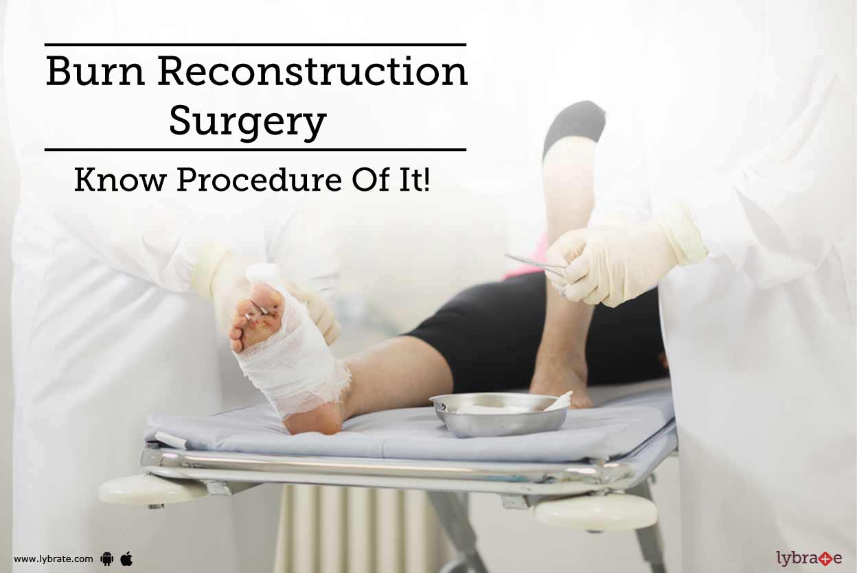 Burn Reconstruction Surgery - Know Procedure Of It! - By Dr. Geetika ...
