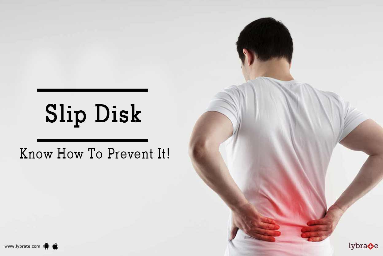 Slip Disk - Know How To Prevent It! - By Dr. Puneet S Shah | Lybrate