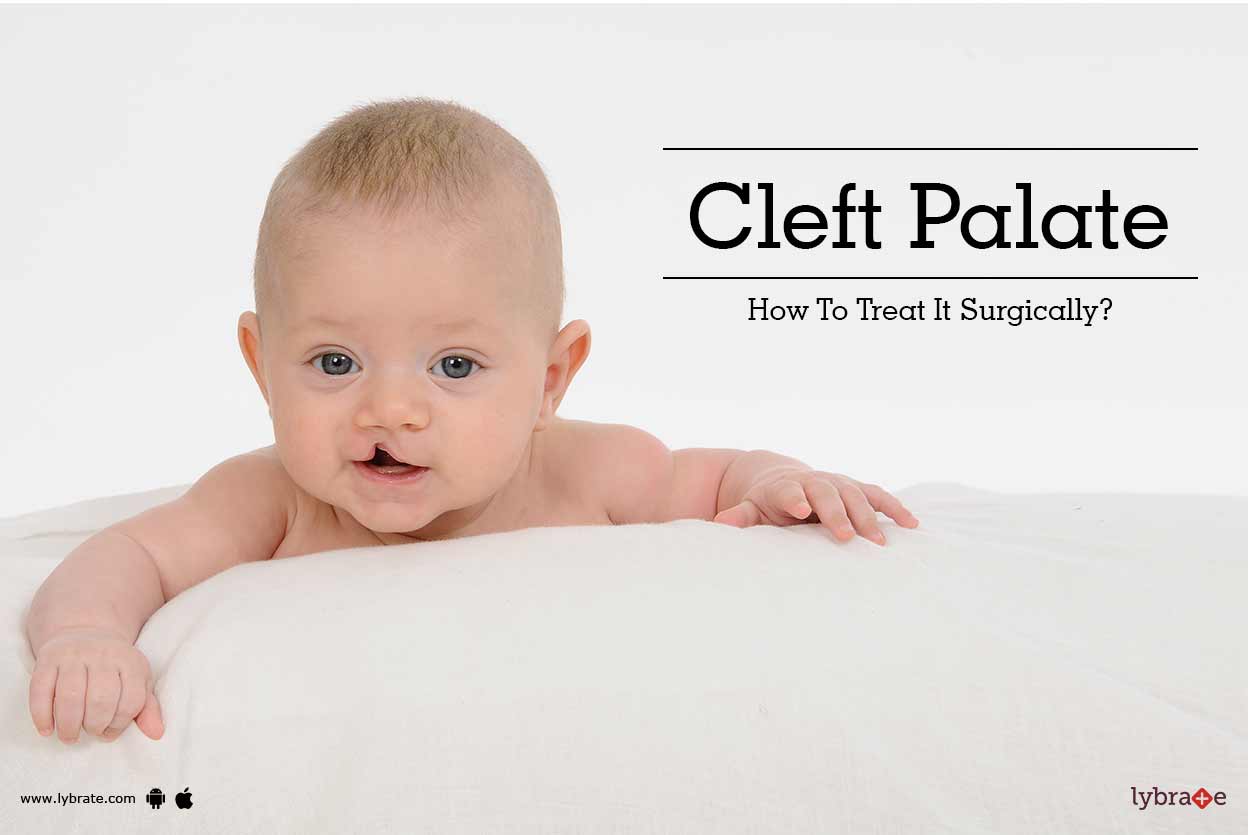 Cleft Palate - How To Treat It Surgically? - By Dr. S.K. Bansal | Lybrate