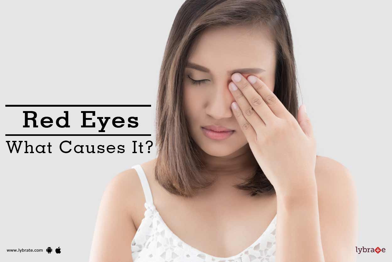 Red Eyes - What Causes It? - By Dr. Pavan Lohiya | Lybrate