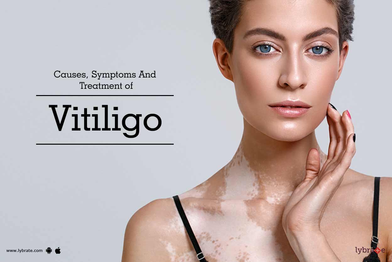 Causes, Symptoms And Treatment of Vitiligo - By Dr. Atula Gupta | Lybrate