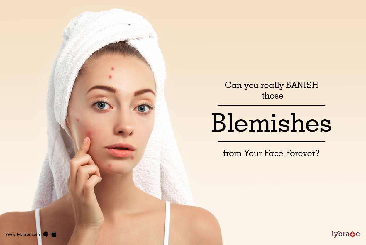 Can You Really Banish Those Blemishes From Your Face Forever? - By Dr ...