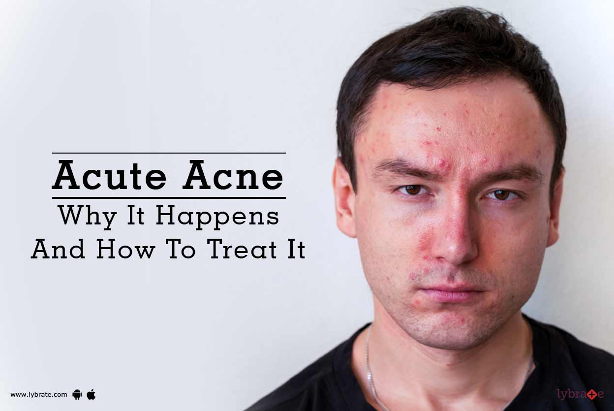 Acute Acne - Why It Happens And How To Treat It? - By Dr. Swetha T ...