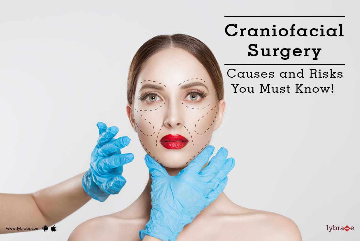 Craniofacial Surgery - Causes and Risks You Must Know! - By Dr. Ajaya ...