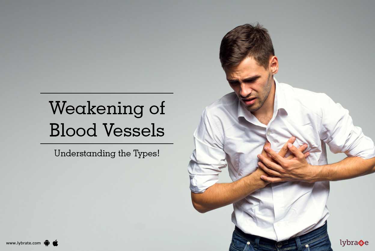 Weakening of Blood Vessels - Understanding the Types! - By Dr. Himanshu ...
