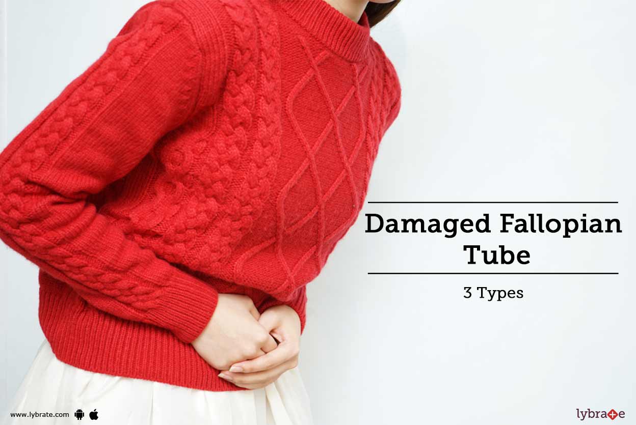 Damaged Fallopian Tubes - 3 Types - By Dr. Aaditi Acharya | Lybrate