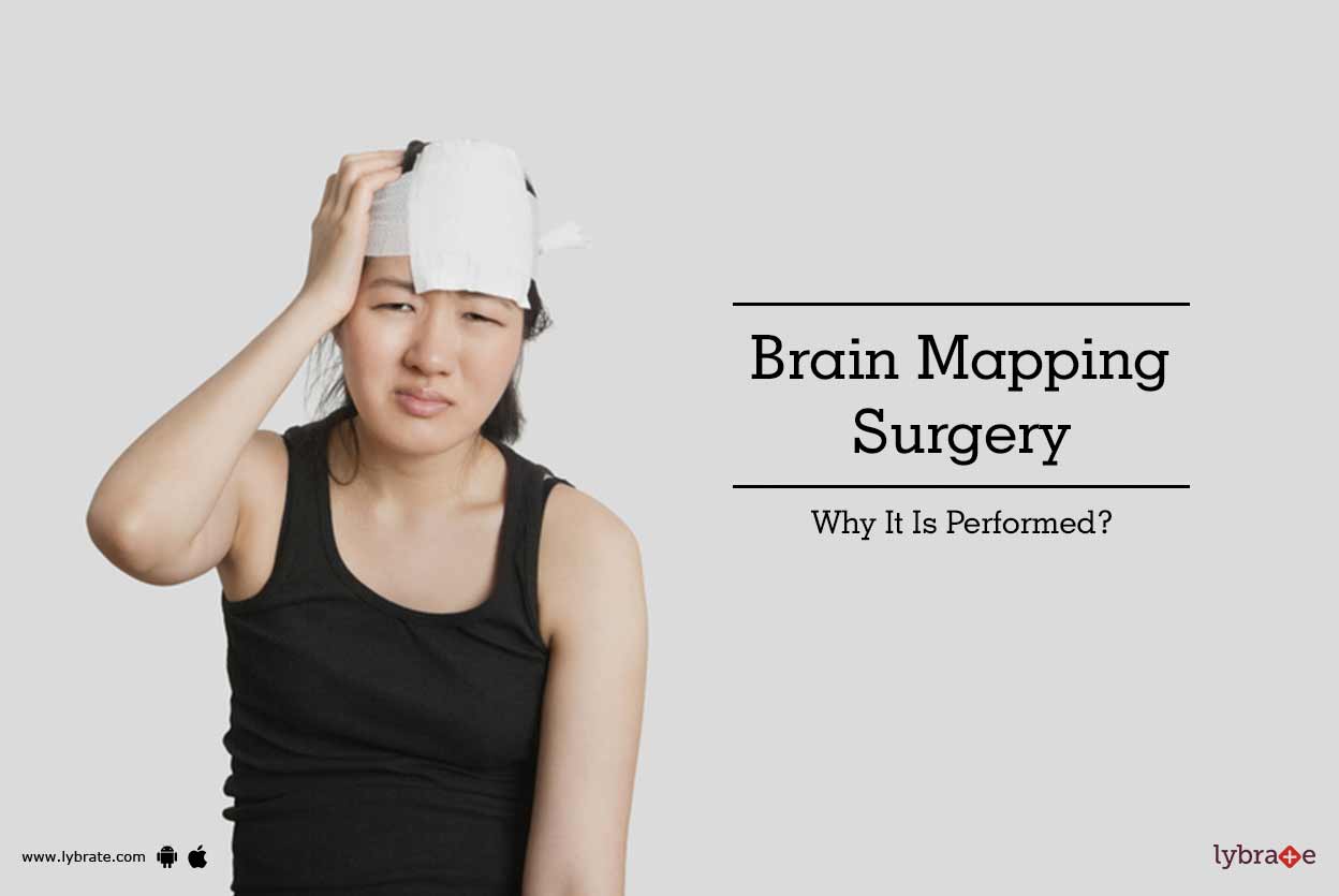 Brain Mapping Surgery - Why It Is Performed? - By Dr. J Mariano Anto ...
