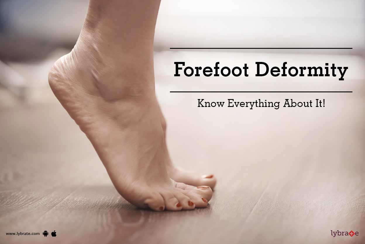 Forefoot Deformity - Know Everything About It! - By Dr. T V Raja | Lybrate