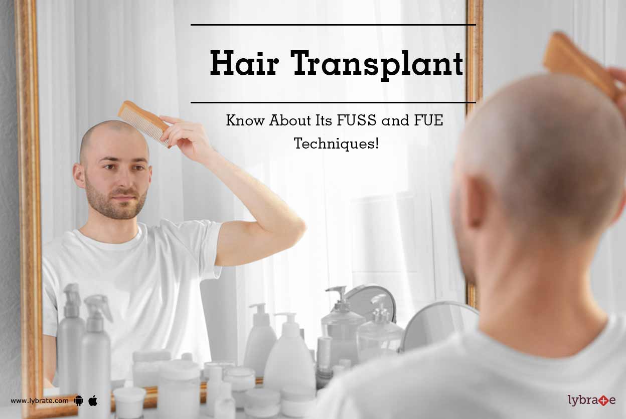 Hair Transplant - Know About Its FUSS and FUE Techniques! - By Dr ...