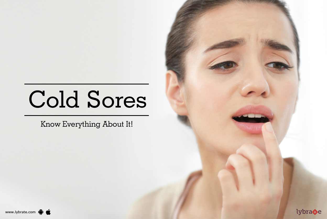Cold Sores - Know Everything About It! - By Dr. Gayathri Devi | Lybrate