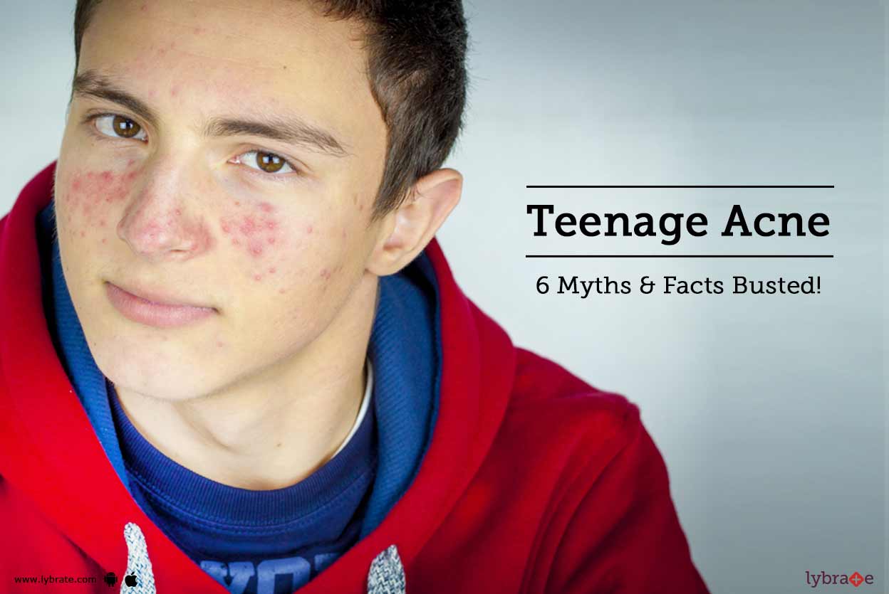 Teenage Acne - 6 Myths & Facts Busted! - By Dr. A.K.Chatterjee | Lybrate