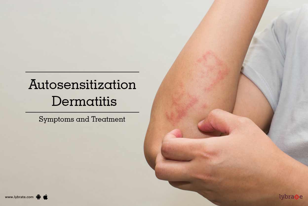 Autosensitization Dermatitis: Symptoms and Treatment - By Dr. Pradeep ...