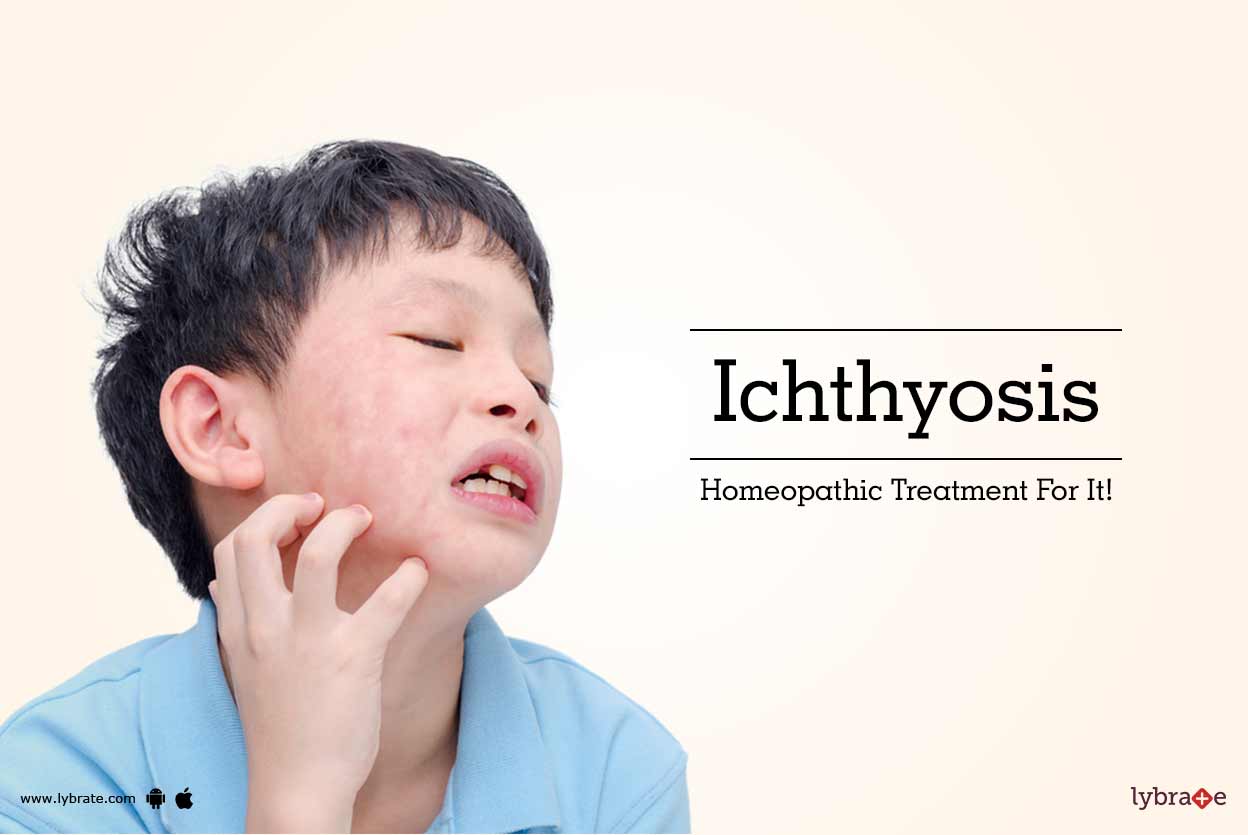 Ichthyosis - Homeopathic Treatment For It! - By Dr. Sonam Jain | Lybrate