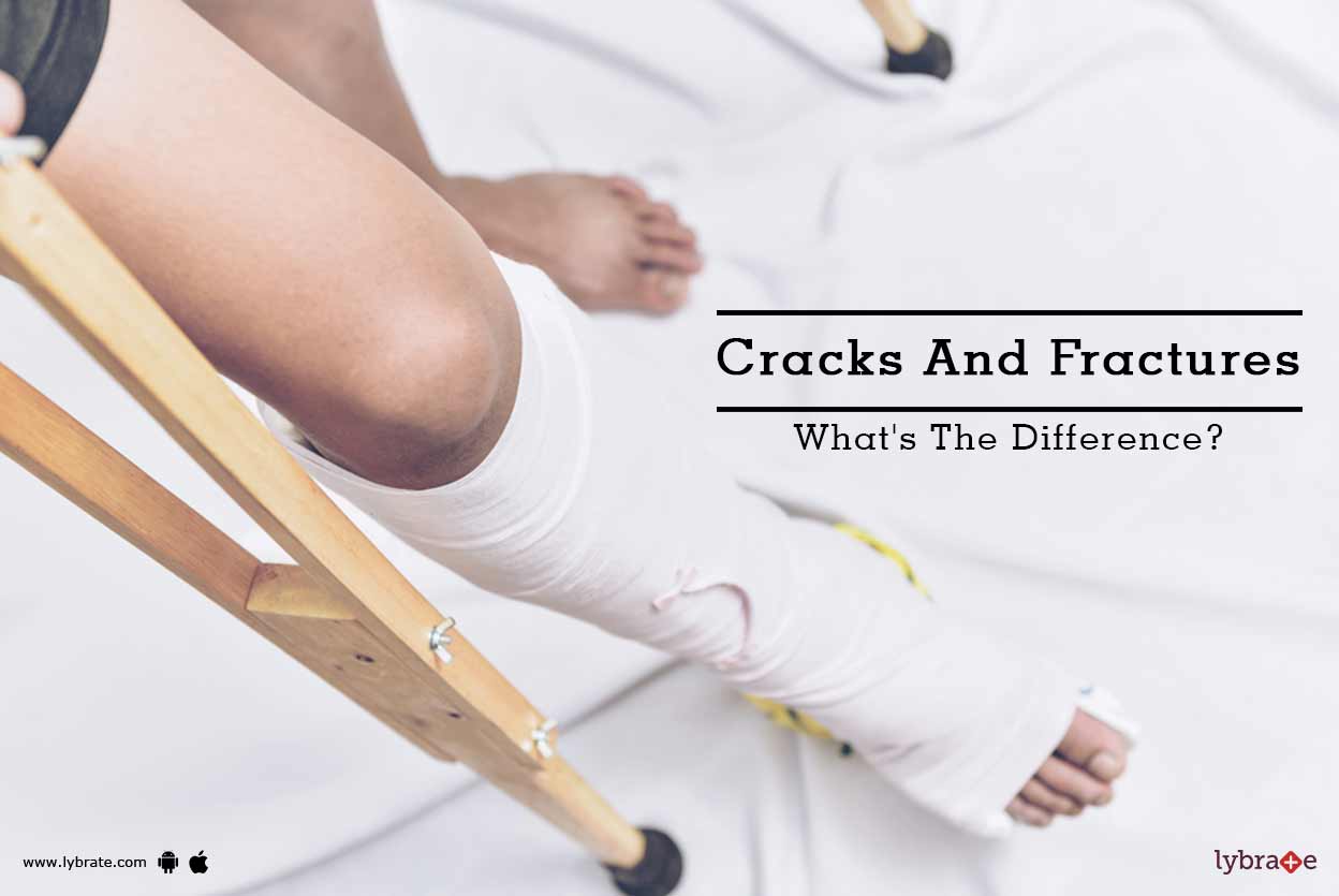 Cracks And Fractures - What's The Difference? - By Dr. Alok Umre | Lybrate