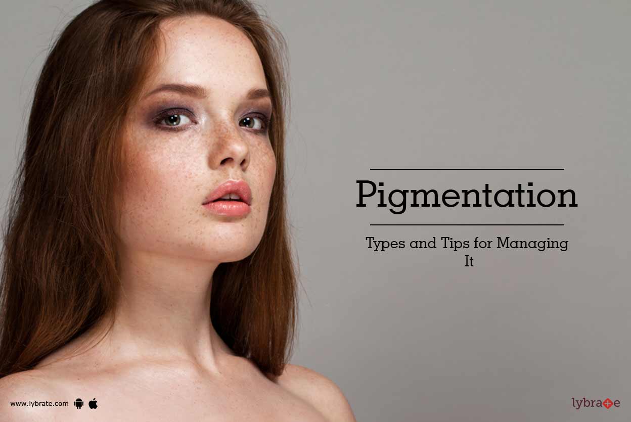 Pigmentation - Types and Tips for Managing It - By Isaac ...