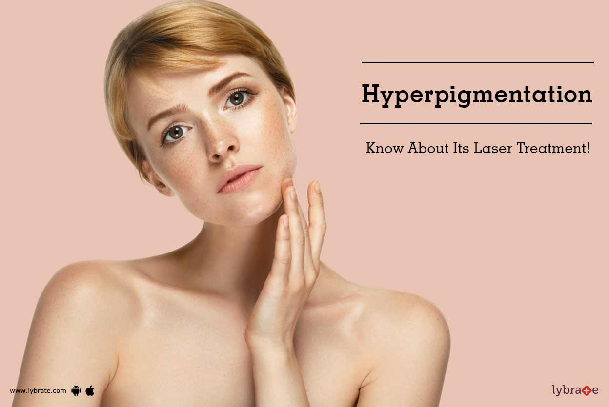 Hyperpigmentation - Know About Its Laser Treatment! - By Dr. Lalit ...