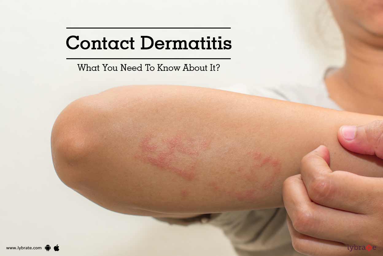 Contact Dermatitis - What You Need To Know About It? - By Dr. Molly ...