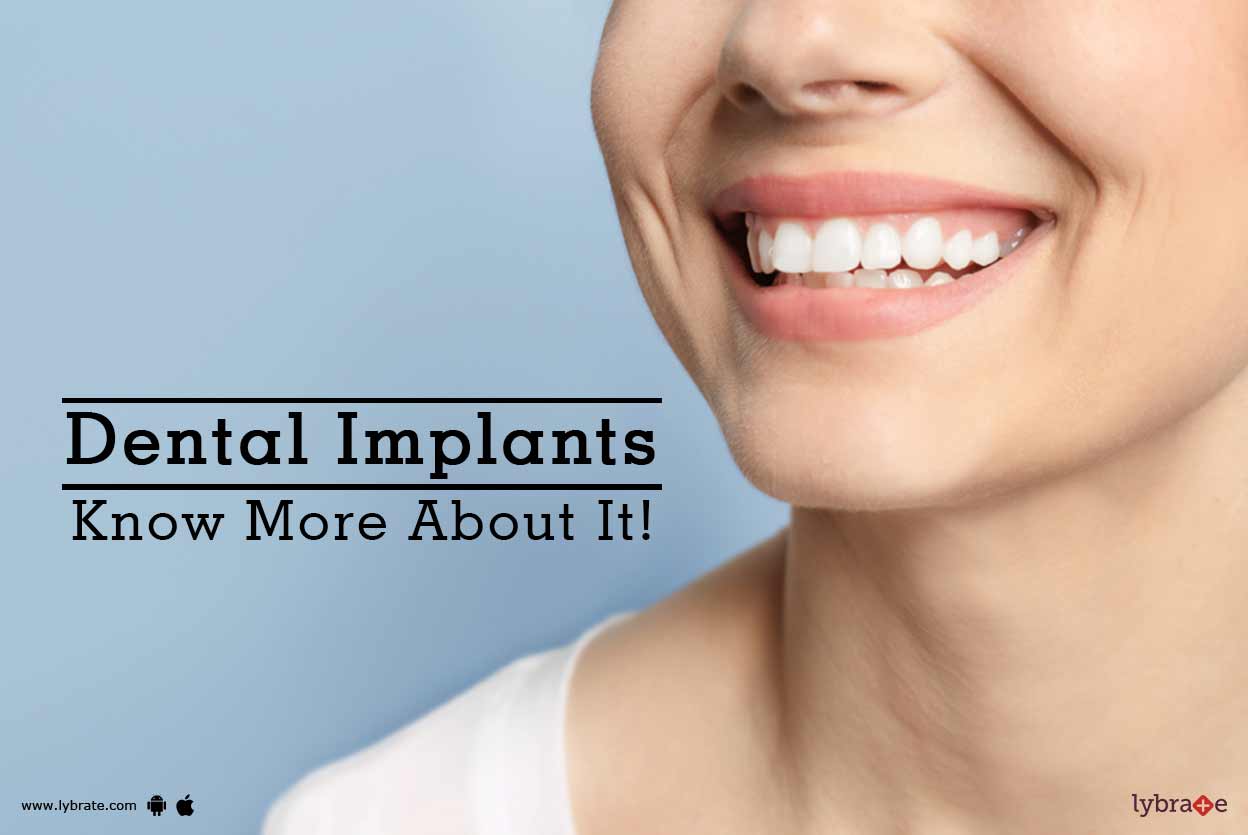 Dental Implants - Know More About It! - By Dr. Vikram Singh Atwal | Lybrate
