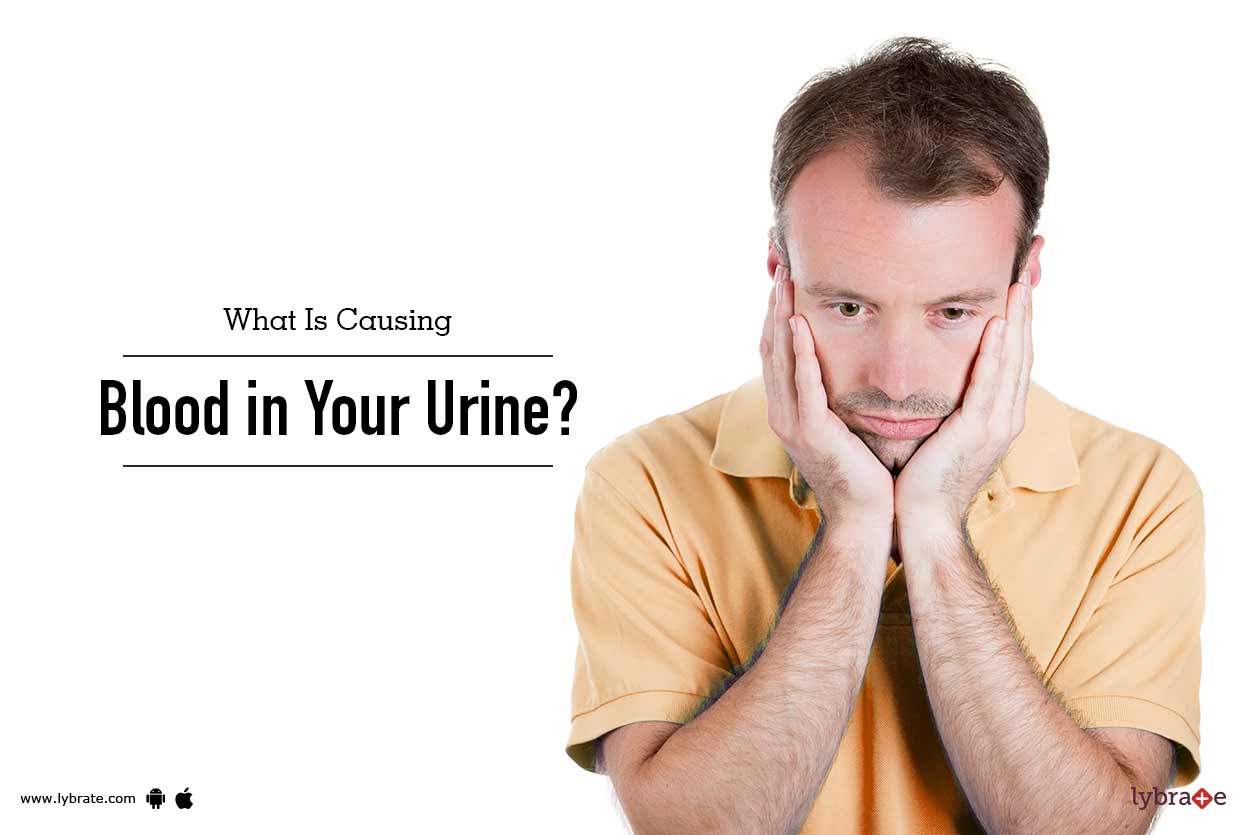 What Is Causing Blood In Your Urine By Dr Sumit Sharma Lybrate what-is-causing-blood-in-your-urine-by-dr-sumit-sharma-lybrate