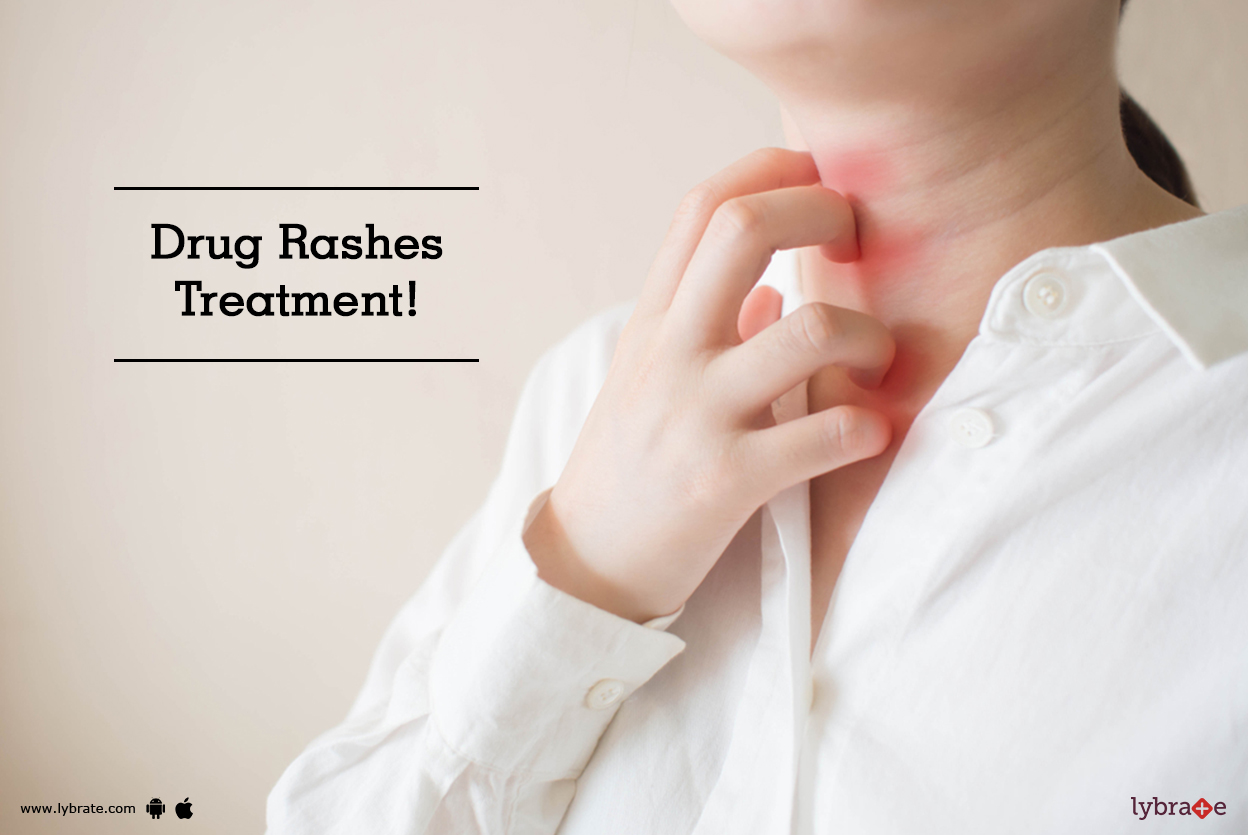 Drug Rashes Treatment! - By Dr. Vanishree S.V | Lybrate