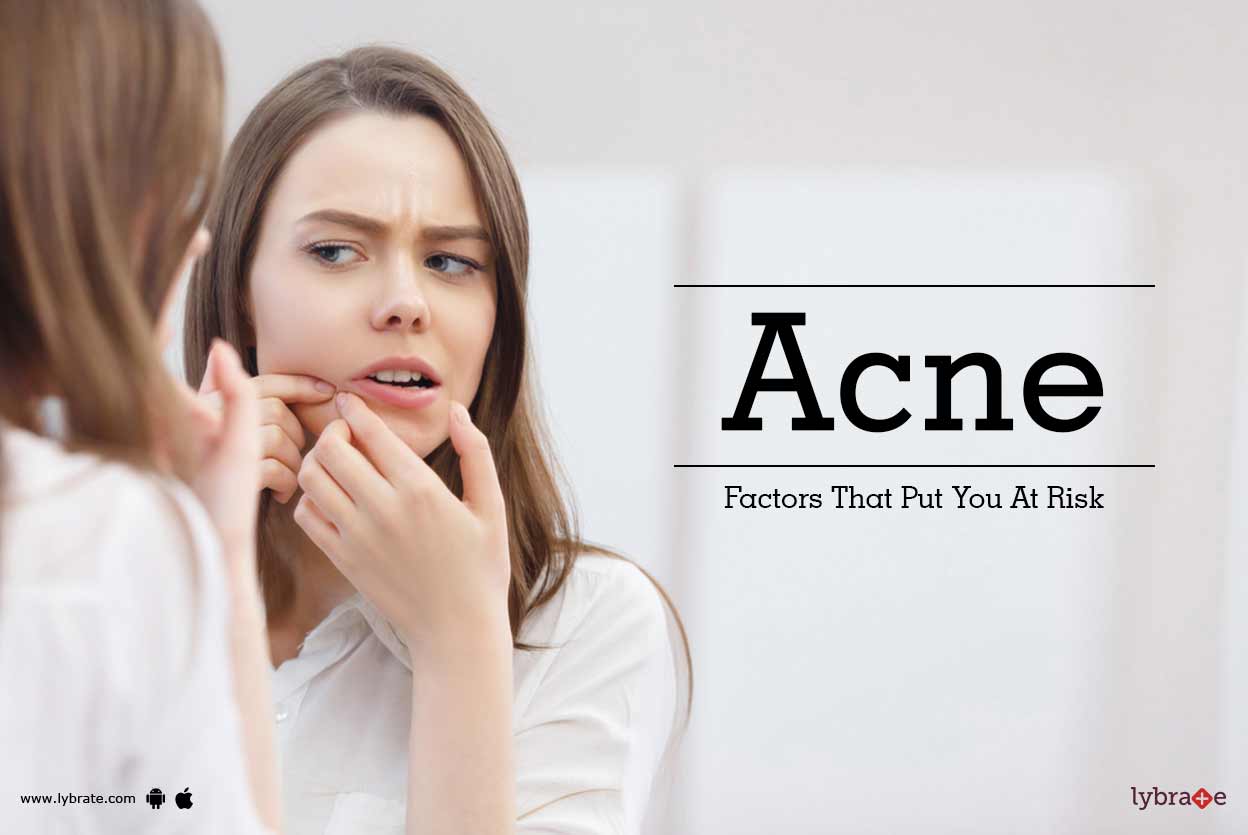 Acne - Factors That Put You At Risk - By Dr. Himanshu Gupta | Lybrate