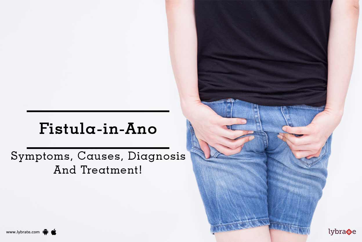 Fistula-in-Ano - Symptoms, Causes, Diagnosis And Treatment! - By Dr ...