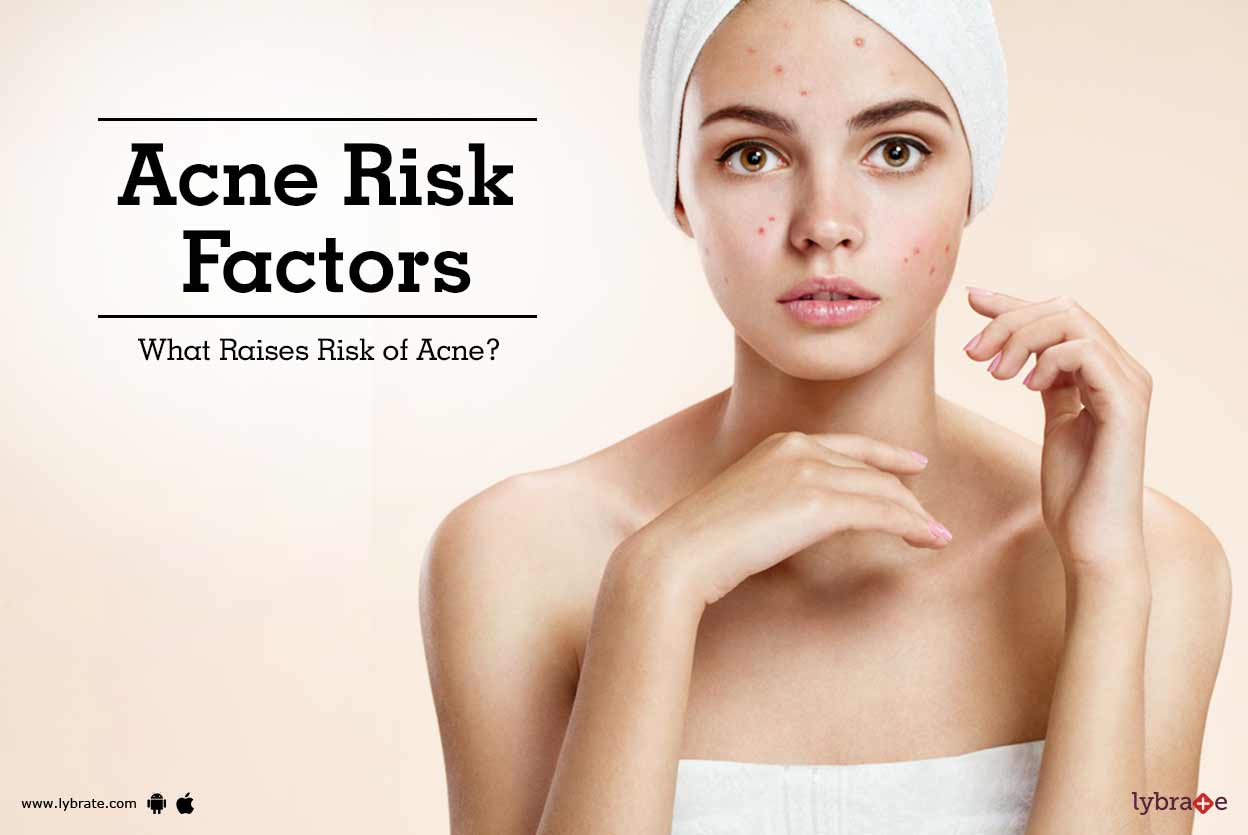 Acne Risk Factors: What Raises Risk of Acne? - By Dr. Mohna | Lybrate