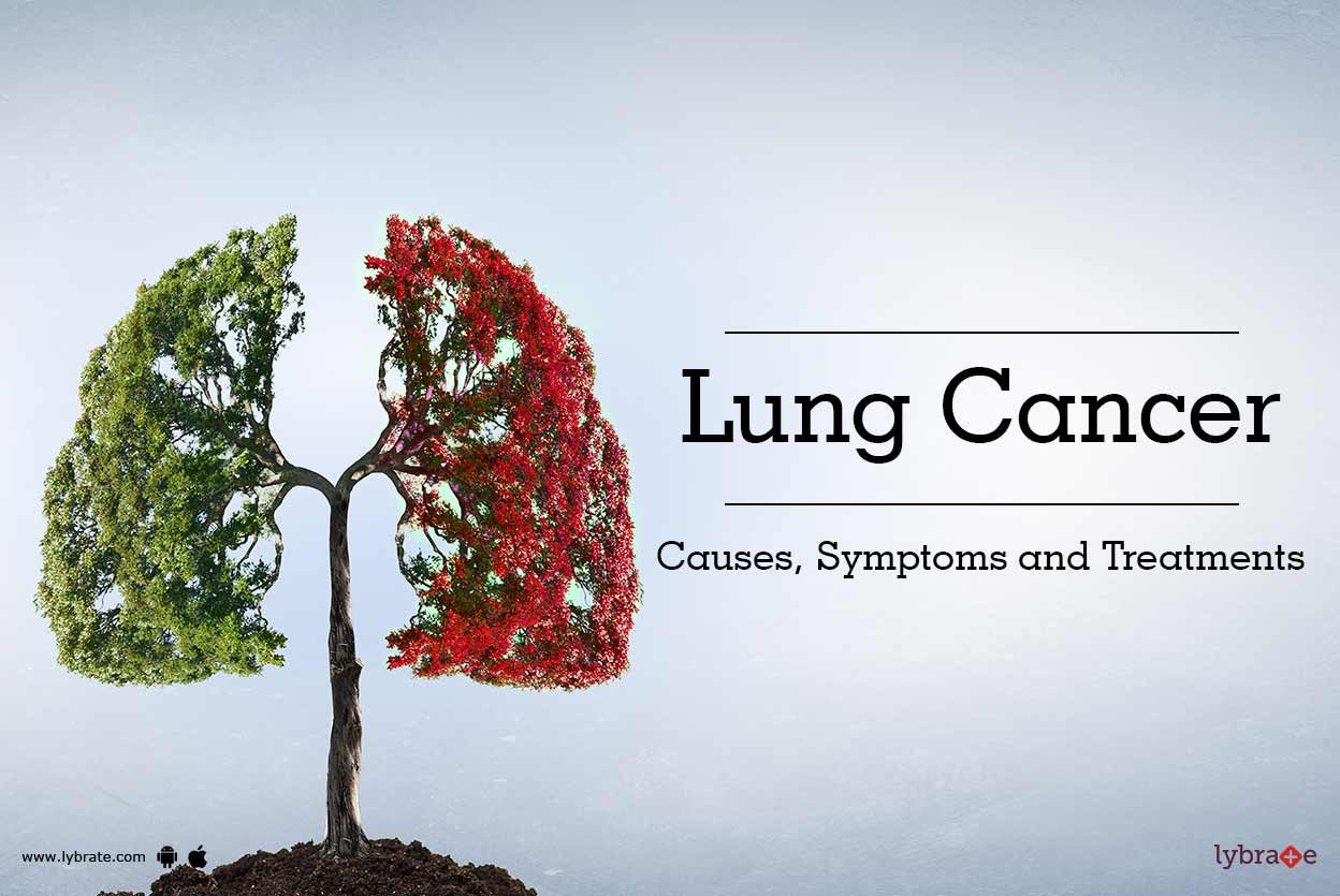 Lung Cancer: Causes, Symptoms and Treatments - By Dr. Mool Chand Gupta ...