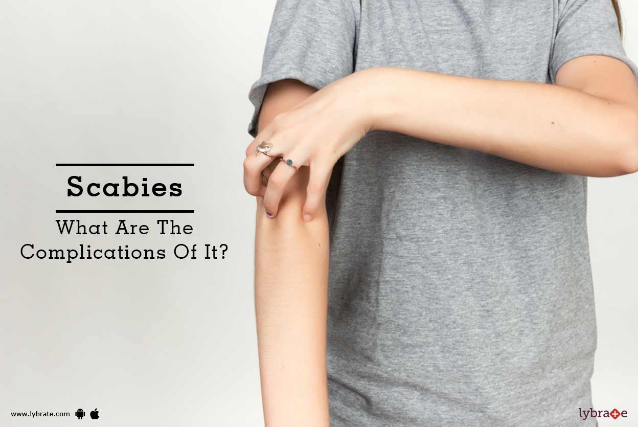 Scabies - What Are The Complications Of It? - By Dr. Dinesh Hawelia ...
