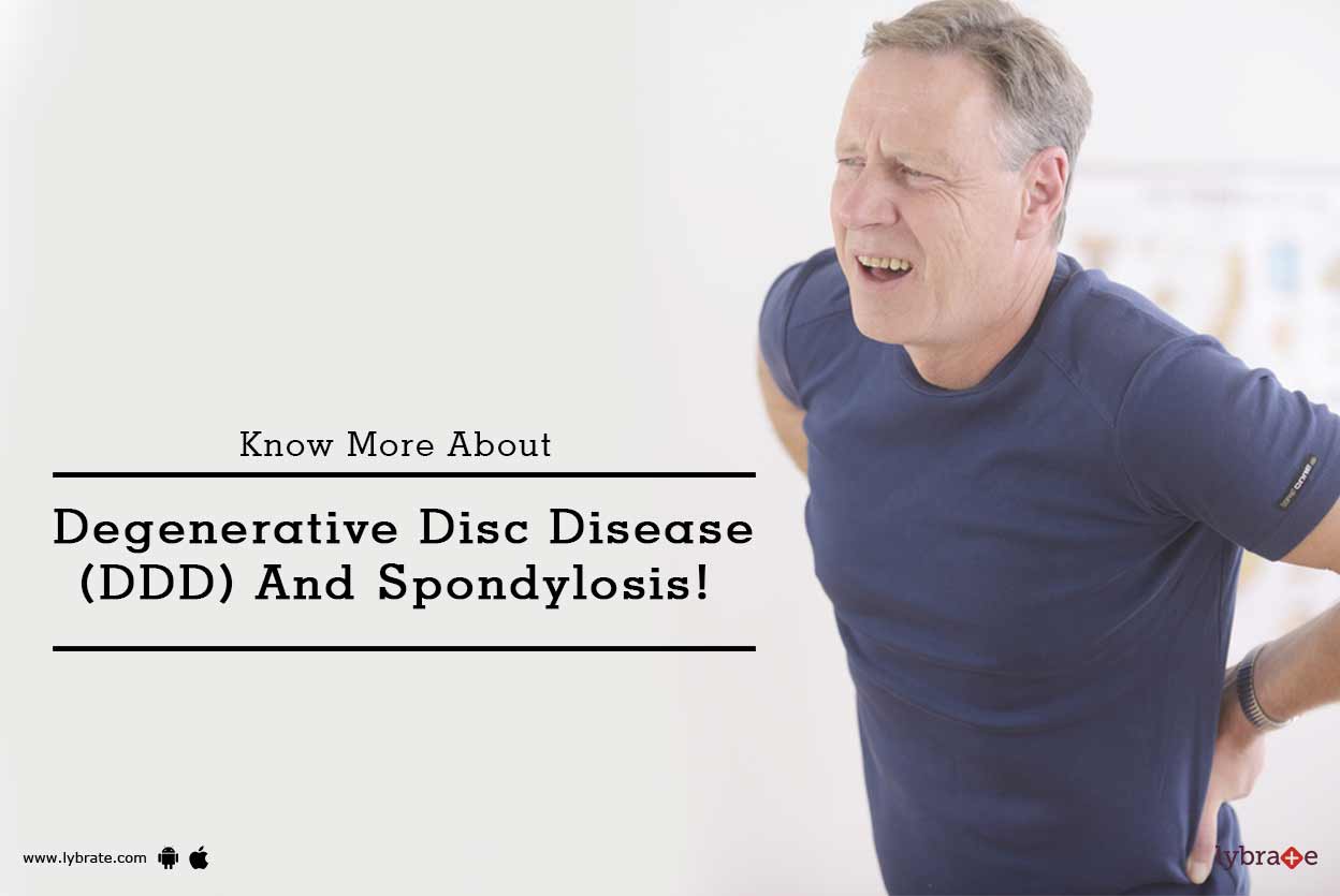 Know More About Degenerative Disc Disease (DDD) And Spondylosis! - By ...