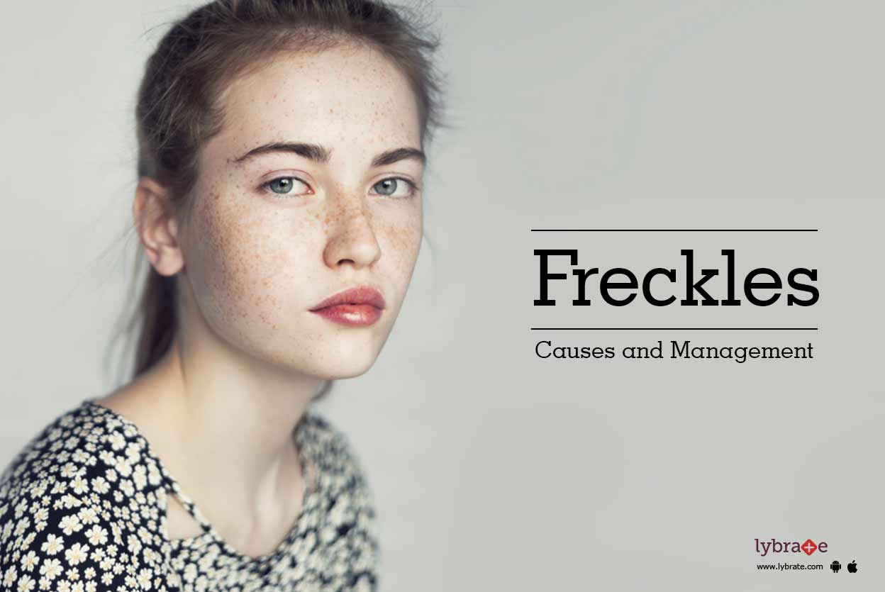 Freckles: Causes and Management - By Dr. Nivedita Dadu | Lybrate