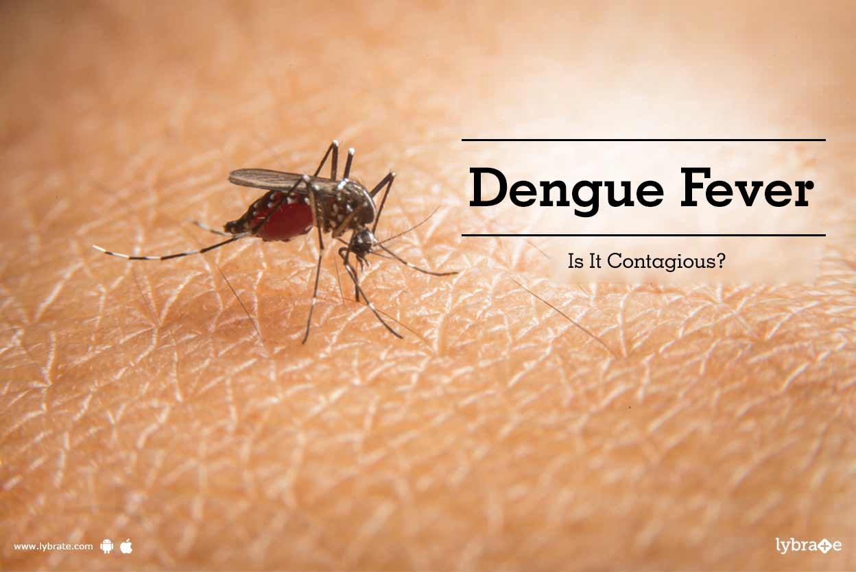 Dengue Fever - Is It Contagious? - By Dr. Nash Kamdin | Lybrate