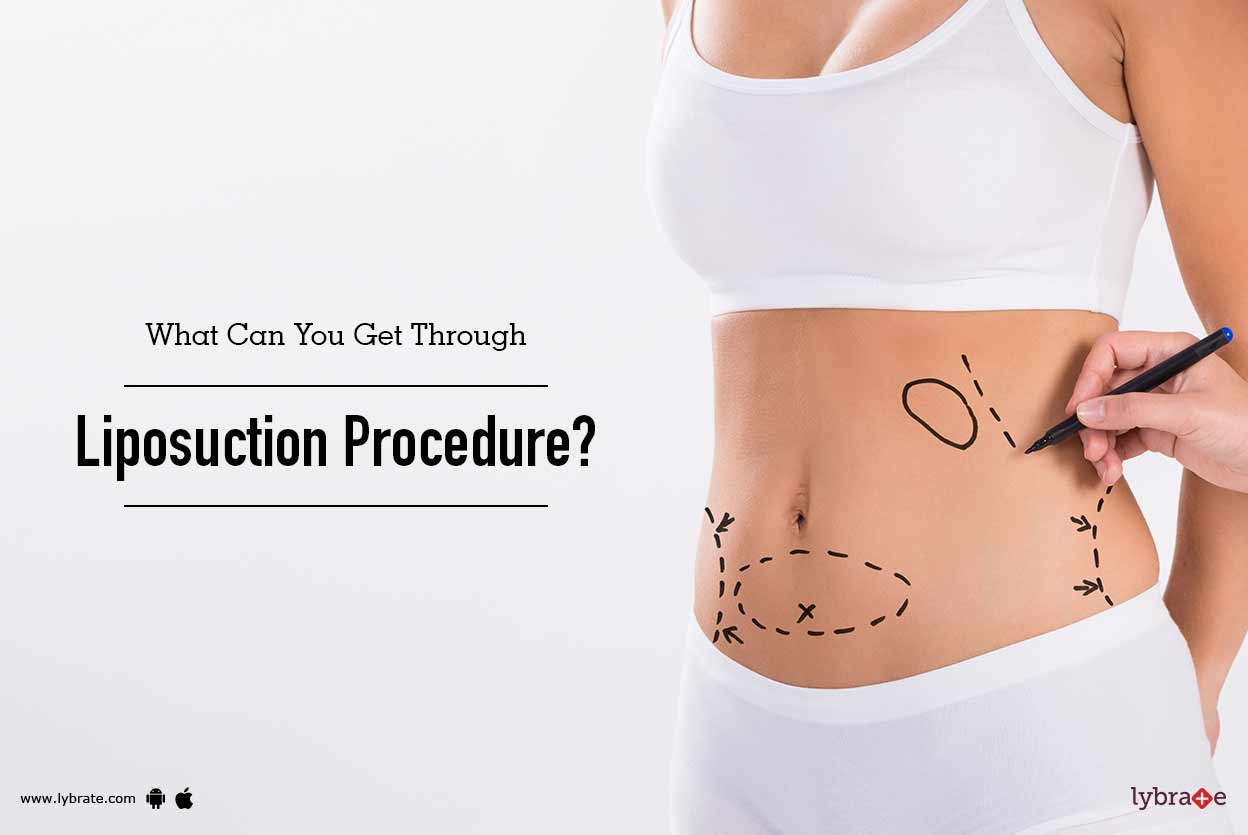 What Can You Get Through Liposuction Procedure? - By Dr. Shobha Jindal ...