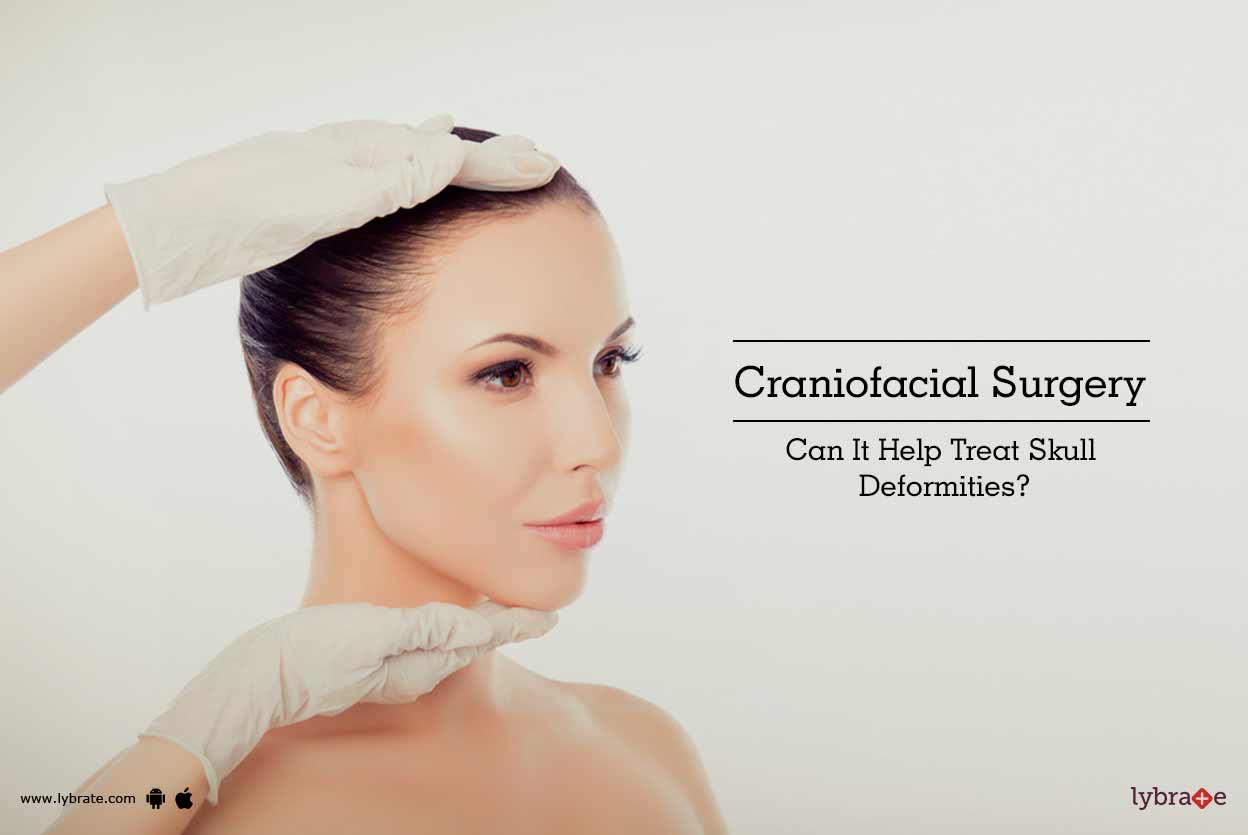 Craniofacial Surgery - Can It Help Treat Skull Deformities? - By Dr ...
