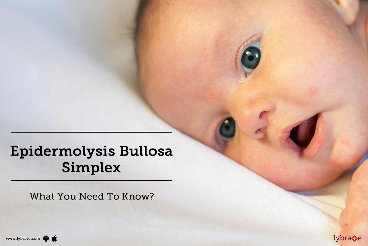 Epidermolysis Bullosa Simplex: What You Need To Know? - By Dr. Himanshu ...