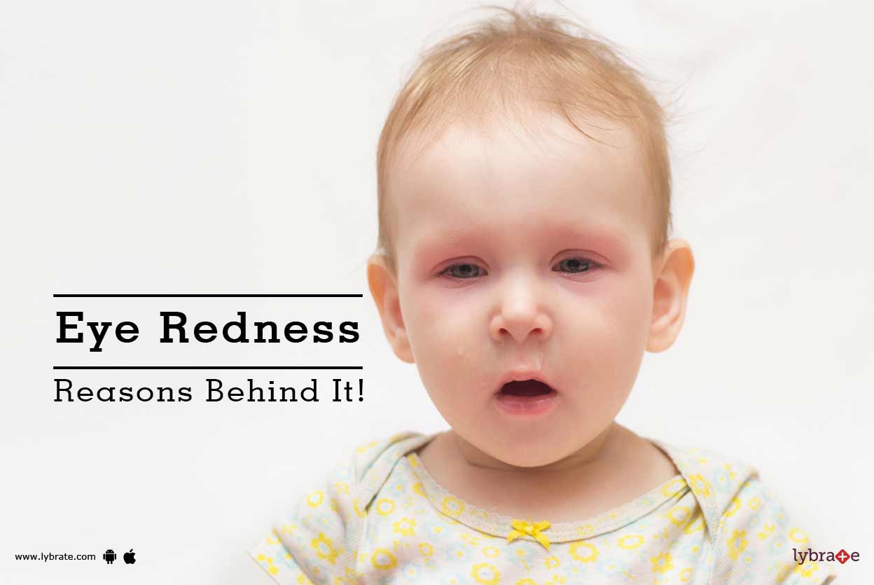 Eye Redness - Reasons Behind It! - By Dr. Ruchi | Lybrate