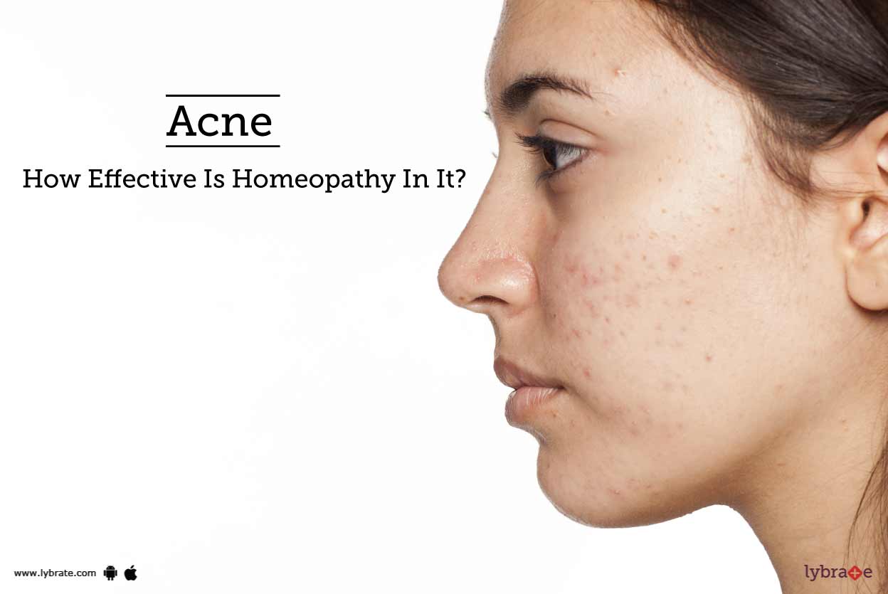 Acne - How Effective Is Homeopathy In It? - By Dr. A M Reddy | Lybrate
