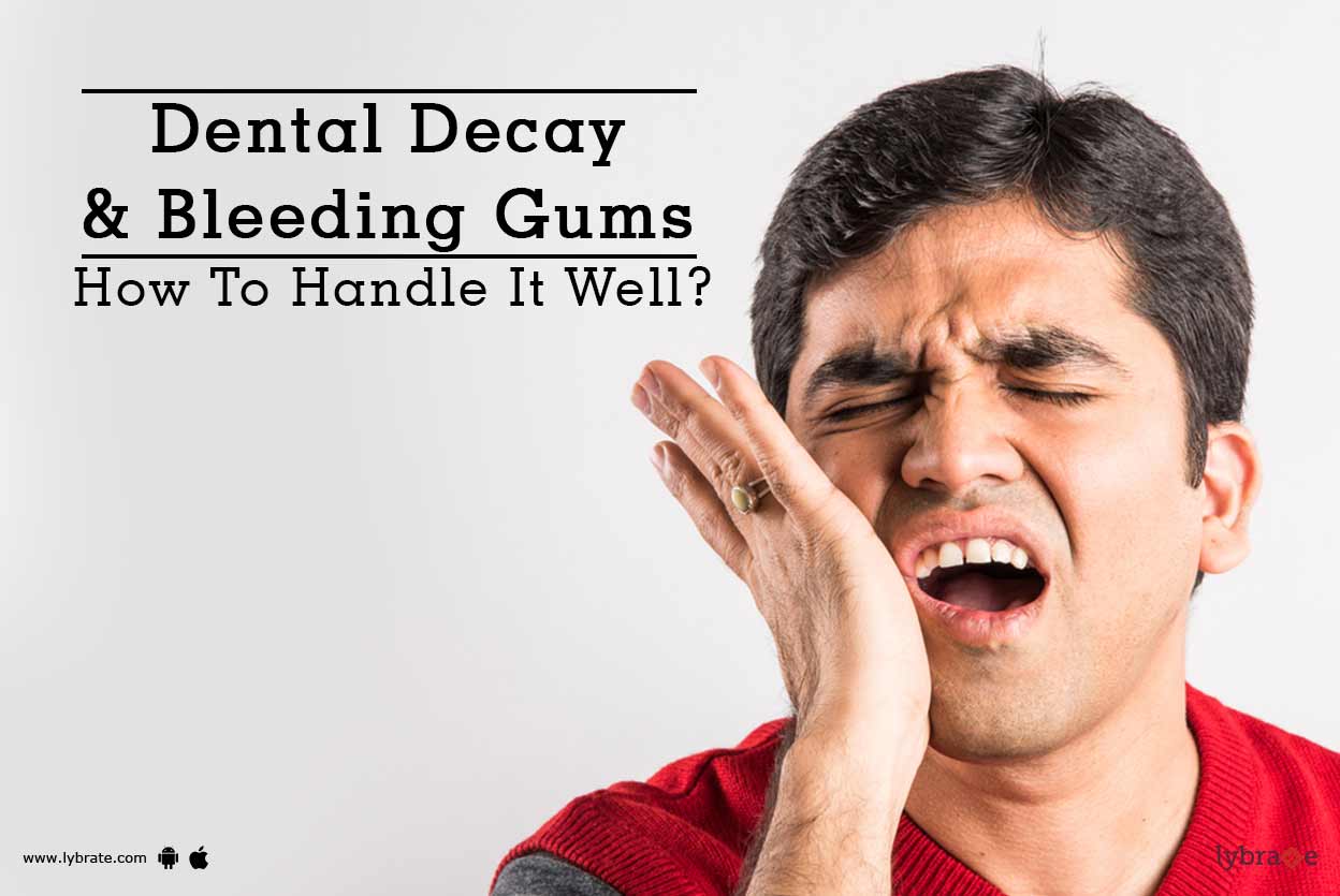 Dental Decay & Bleeding Gums - How To Handle It Well? - By Dr. Anupreet ...