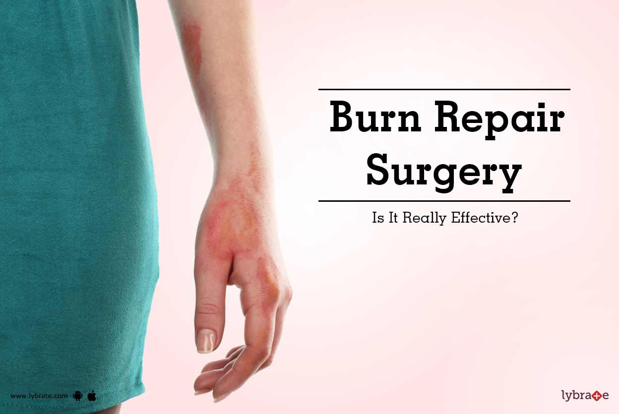 Burn Repair Surgery - Is It Really Effective? - By Dr. Sahebgowda ...