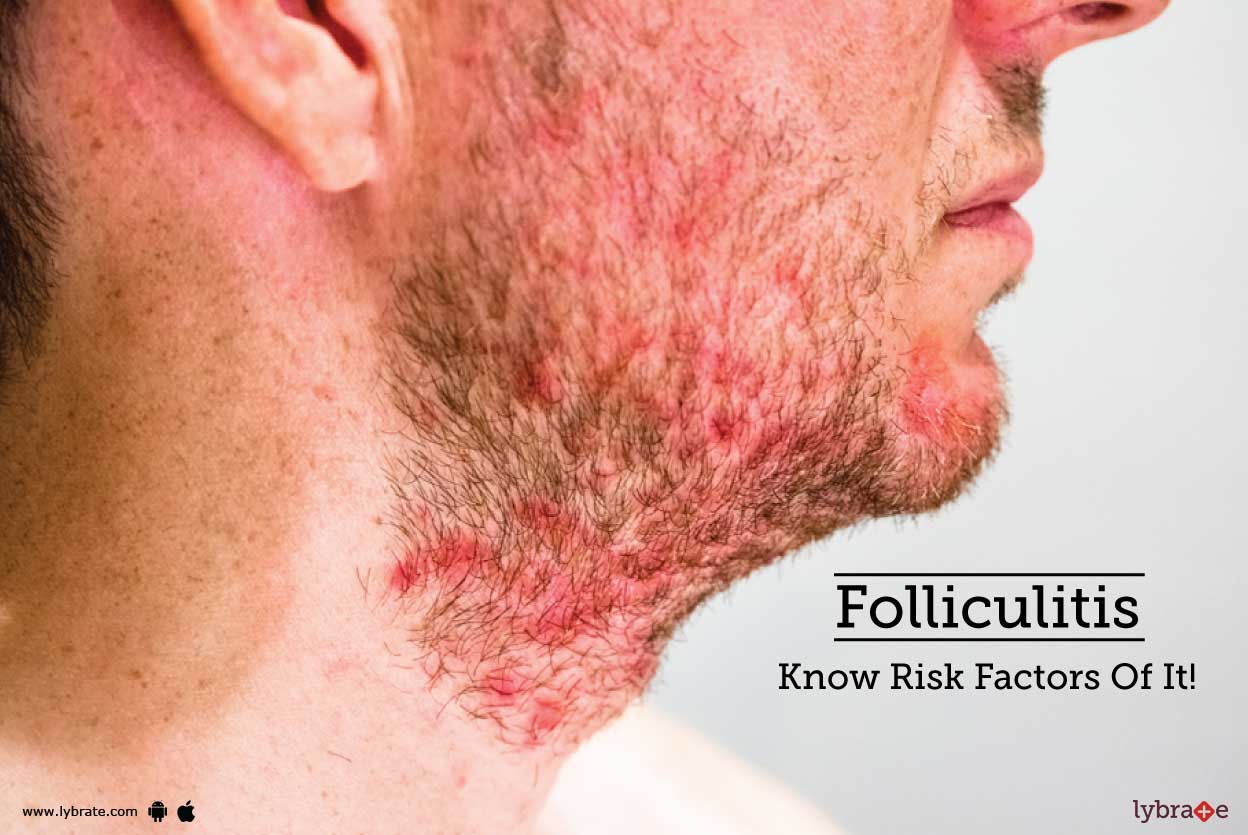 Folliculitis - Know Risk Factors Of It! - By Dr. Ganesh Avhad | Lybrate