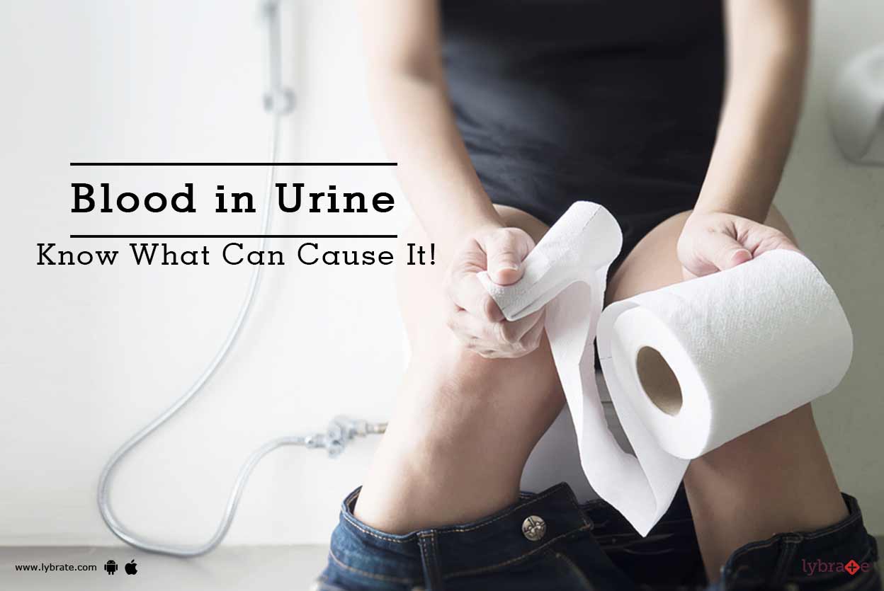 Blood in Urine - Know What Can Cause It! - By Dr. Ashish Gupta | Lybrate