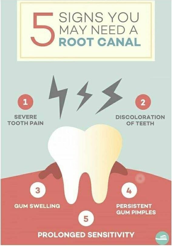 Common Signs Of Root Canal Treatment! - By Dr. Hetal Chheda | Lybrate