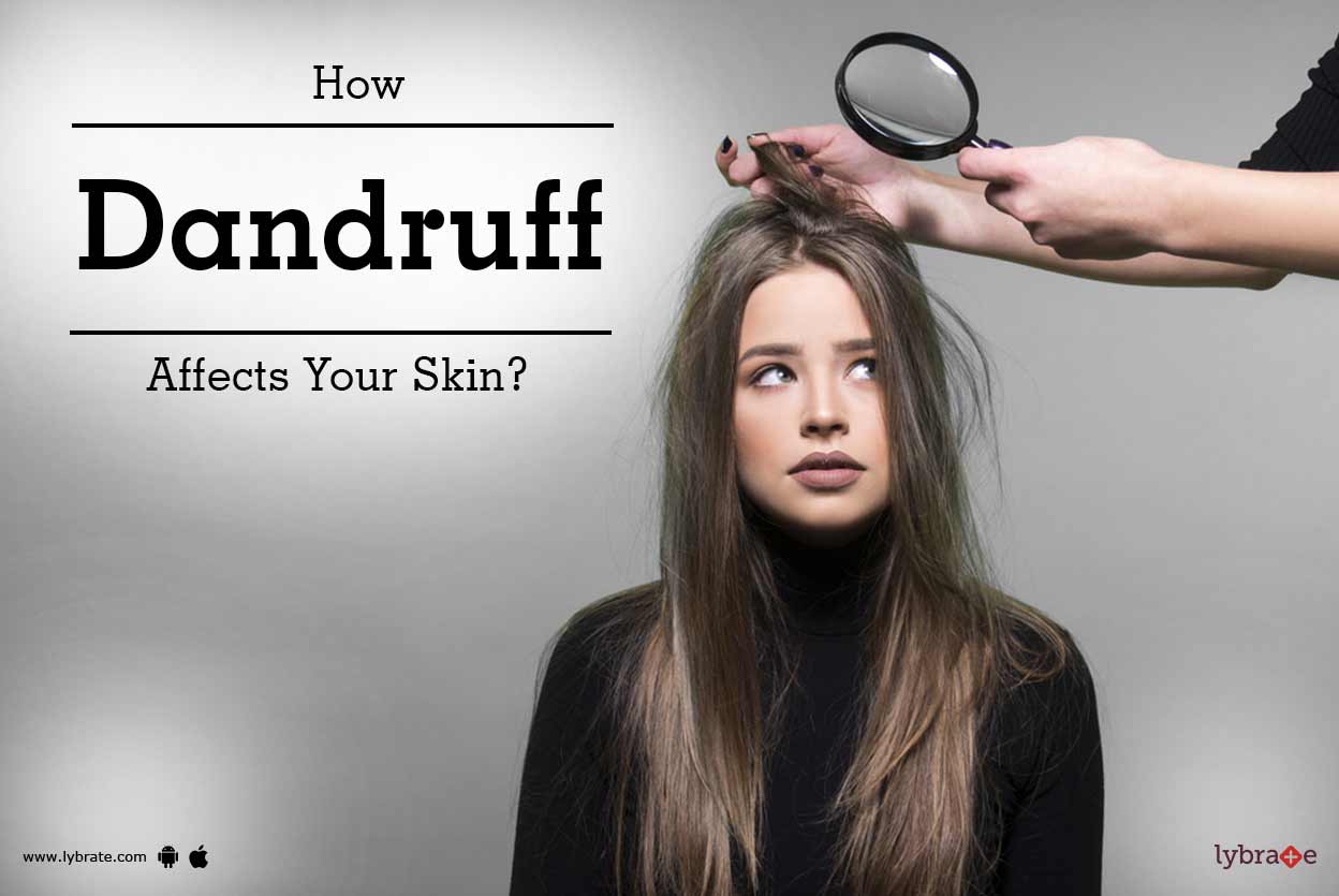 How Dandruff Affects Your Skin? - By Dr. Sandesh Gupta | Lybrate