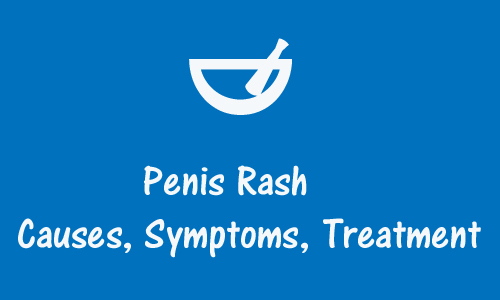 When a Penis Rash Is Something to Worry About! - By Dr. Vinod Raina ...