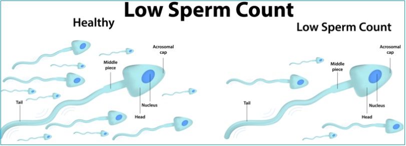 Reproduction And Its Complications! - By Dr. Vinod Raina | Lybrate